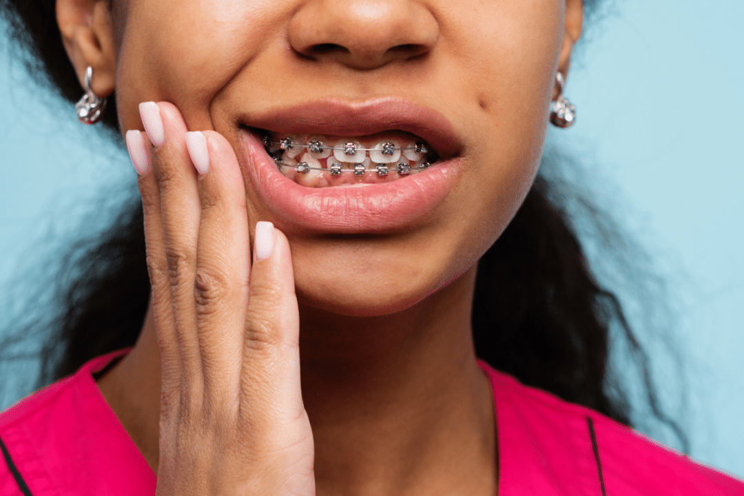 5 Orthodontic Problems You Can Fix at Home Easily